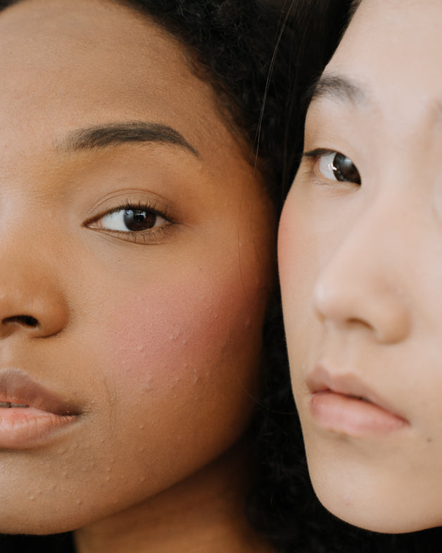 The Gut-Skin Connection – rachellarsson